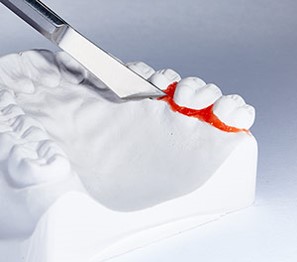 Tech Tune Up Archives — Eurodontic