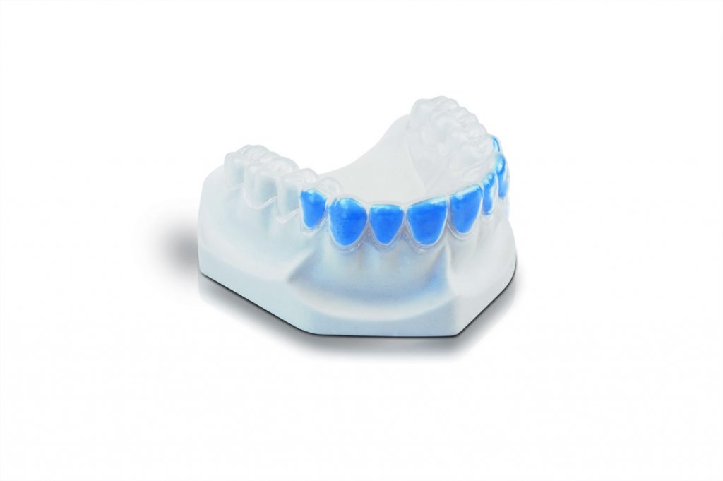 How to fabricate a bleaching tray — Eurodontic