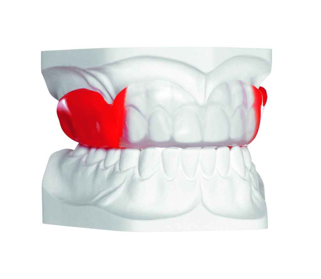 BIOPLAST® Xtreme Kit — Eurodontic